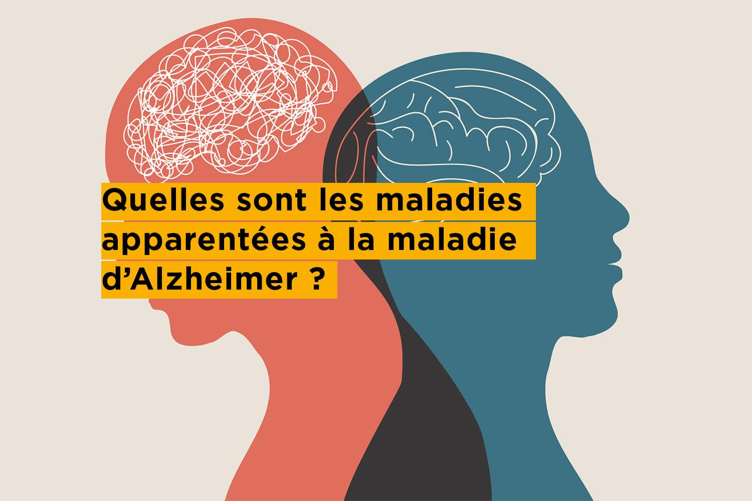 Maladie d’Alzheimer et maladies apparentées : mieux les différencier ...
