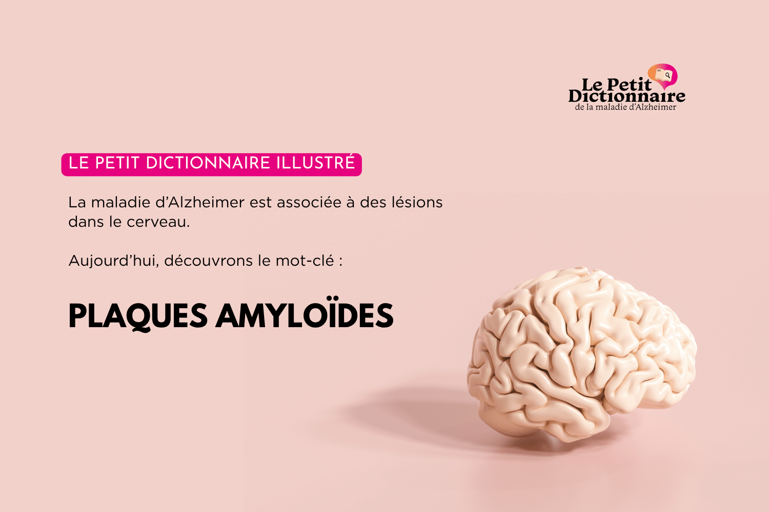 Qu'est-ce qu'une plaque amyloïde ? - Fondation Alzheimer