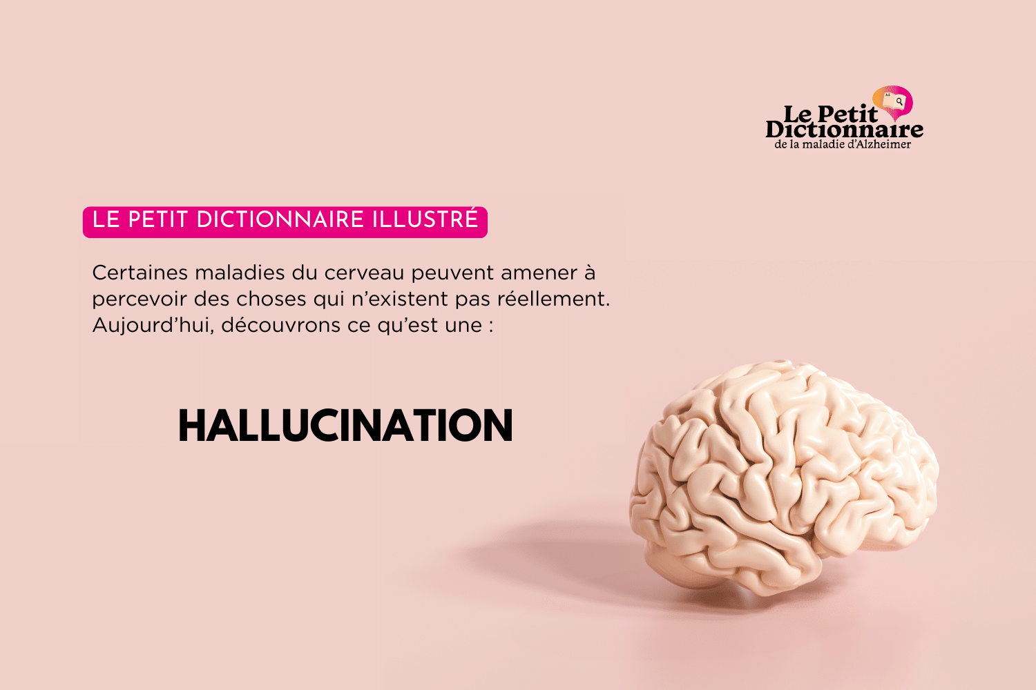 Alzheimer : comment réagir face aux hallucinations ? - Fondation Alzheimer
